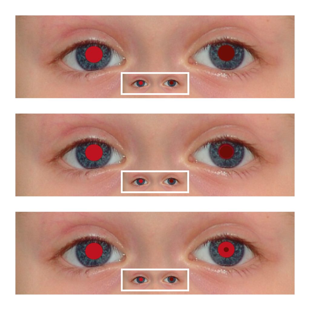 Test Brücknera - Sklep Plus Ultra