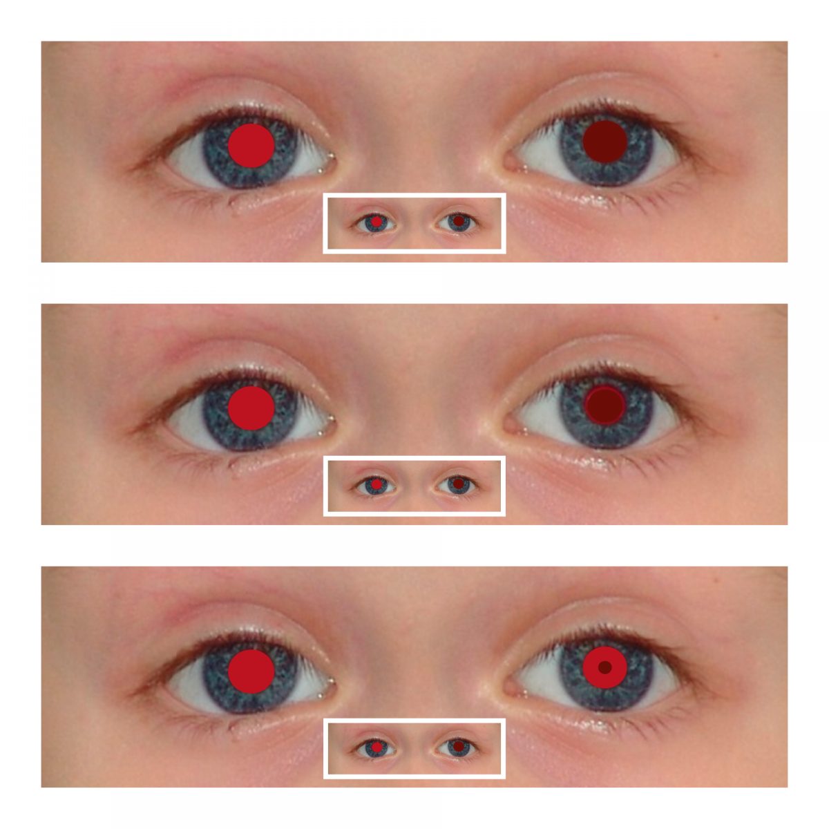 Test Brücknera - Sklep Plus Ultra